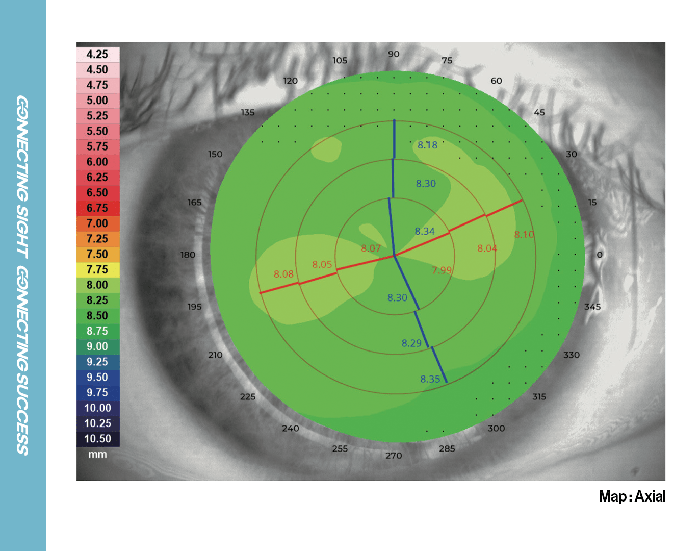 One Device Corneal Topography & Dry Eye Diagnosis | Blog_en | Huvitz